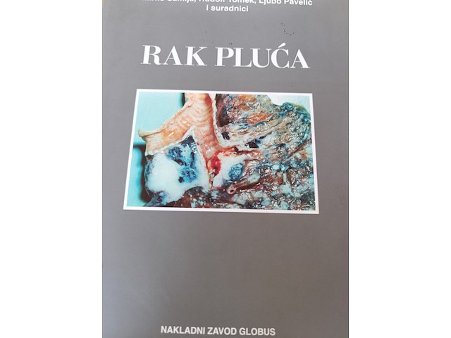 Rak pluća – Šamija, Tomek, Pavelić i saradnici