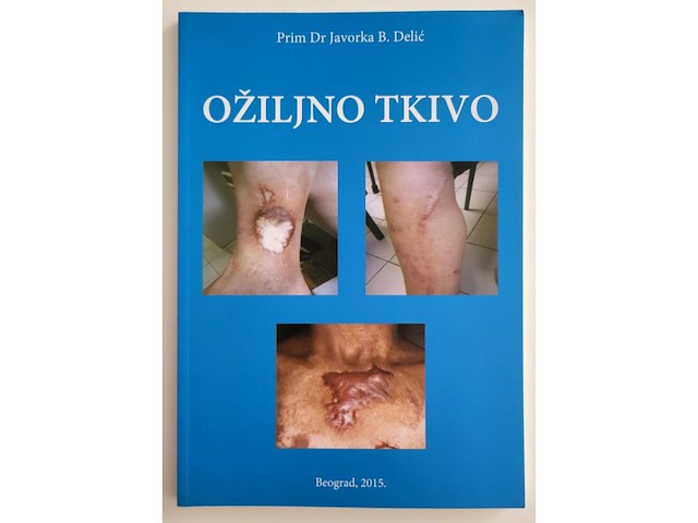 Ožiljno tkivo - Dr. Javorka B. Delić