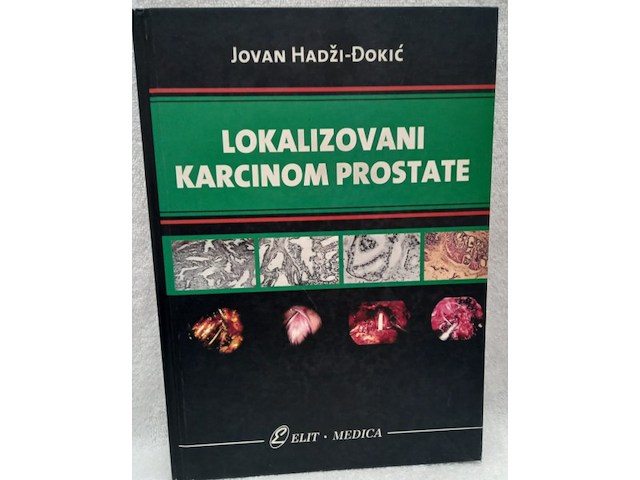 Lokalizovani karcinom prostate