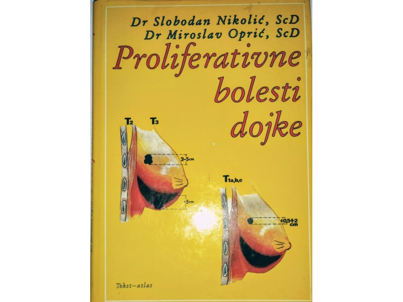 Proliferativne bolesti dojke