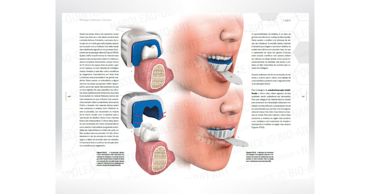 HIRUŠKI PAPIR ZA PAKERICU 100MM X 100M