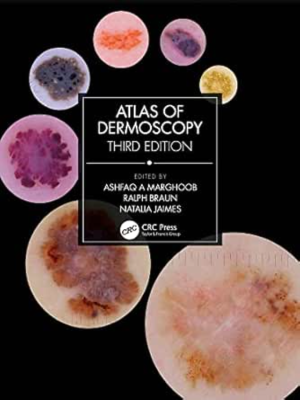 Atlas of Dermoscopy 3rd Edition