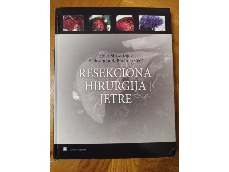 Resekciona hirurgija jetre - Eldar M. Gadžijev