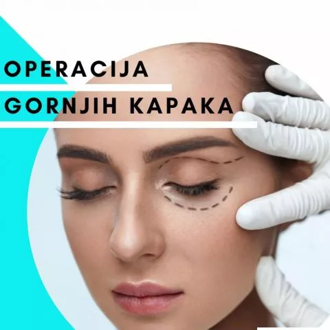 GORNJI KAPCI