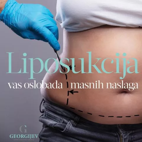LIPOSUKCIJA STOMAKA