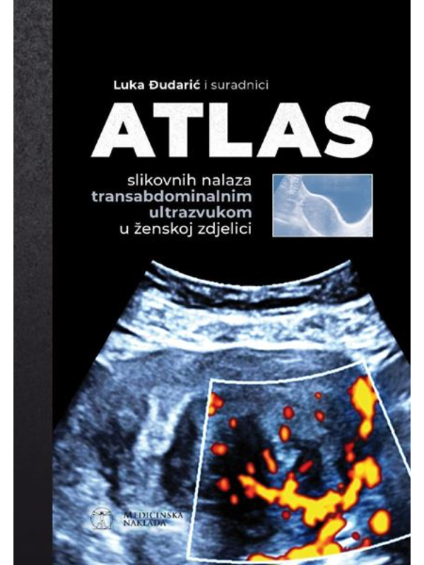 ATLAS slikovnih nalaza transabdominalnim ultrazvukom u ženskoj zdjelici