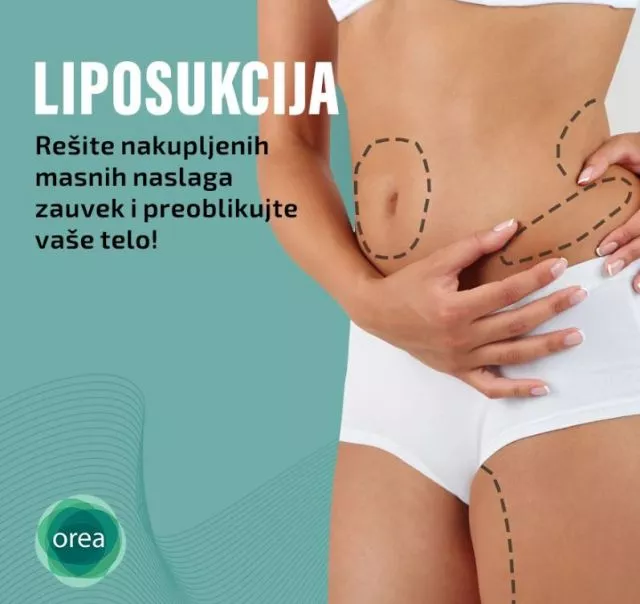 Laserska liposukcija i PAL (Power-Assisted Liposuction)