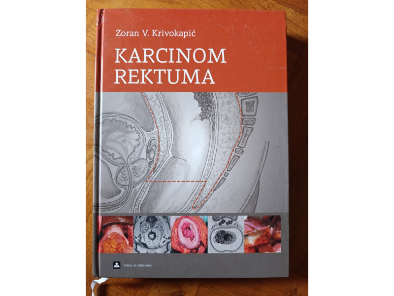 Karcinom Rektuma - Zoran V. Krivokapic