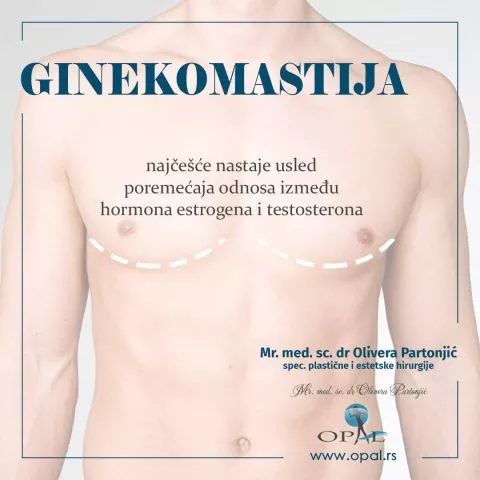 GINEKOMASTIJA MANJA