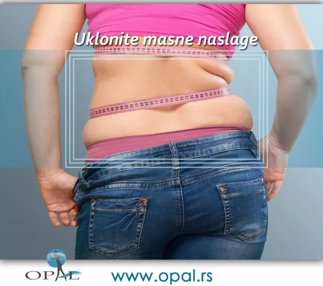 LIPOSUKCIJA STOMAKA