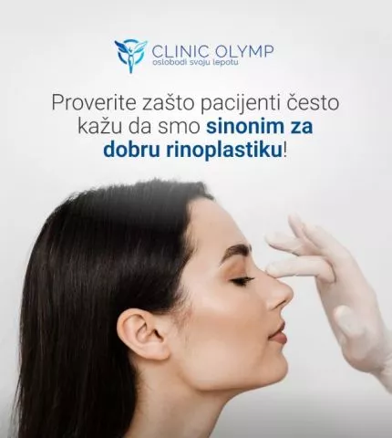 Rinoplastika
