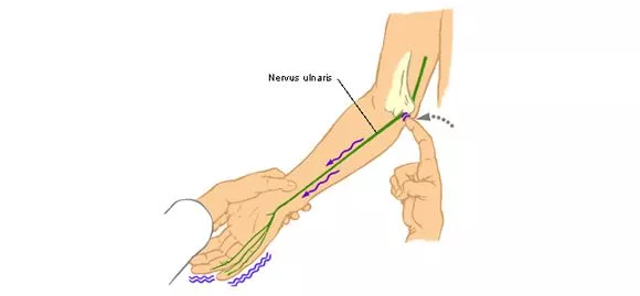 Kompresija n.ularis-a