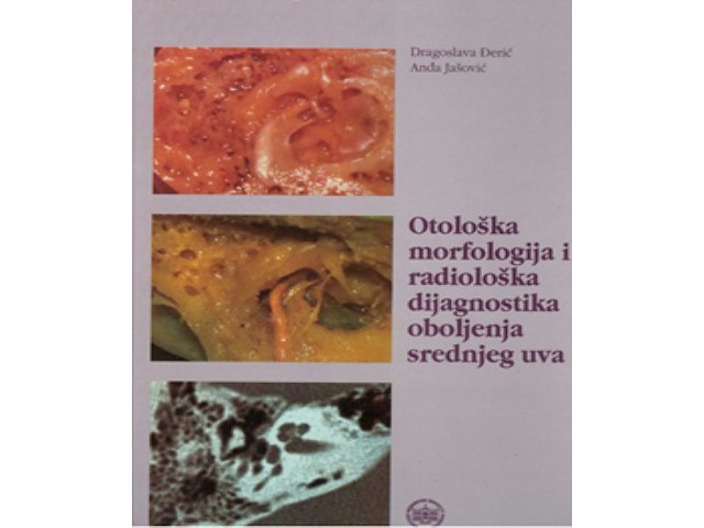 Otološka morfologija i radiološka dijagnostika oboljenj