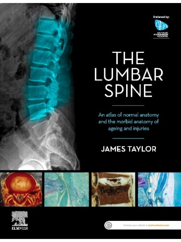 The Lumbar Spine An Atlas of Normal Anatomy and the Morbid Anatomy of Ageing and Injury