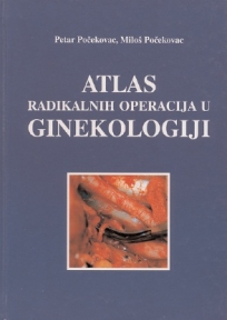 Atlas radikalnih operacija u ginekologiji