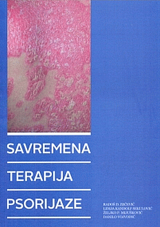 Savremena terapija psorijaze