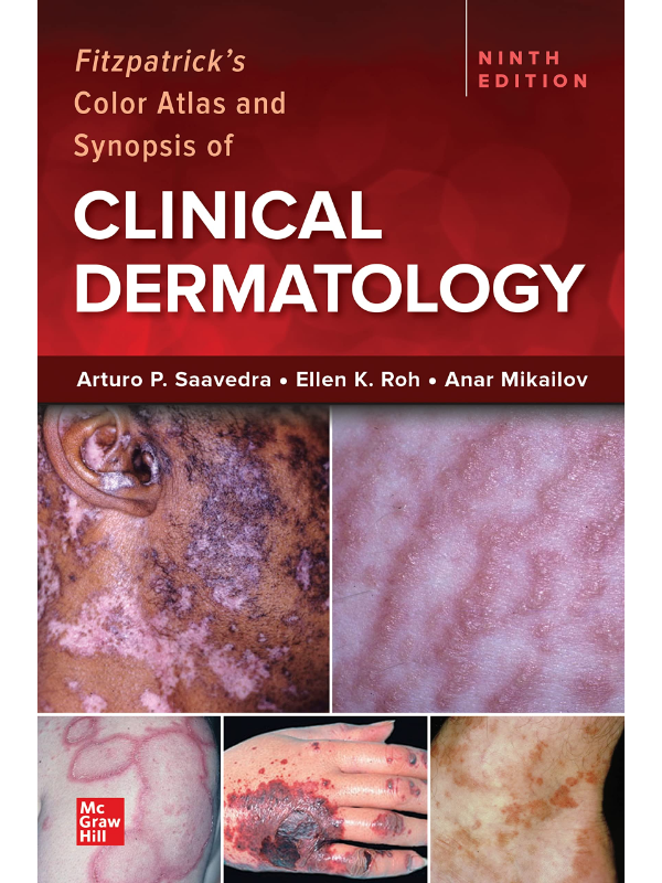 Ie Fitzpatrick’s Color Atlas And Synopsis Of Clinical Dermatology, 9th Edition