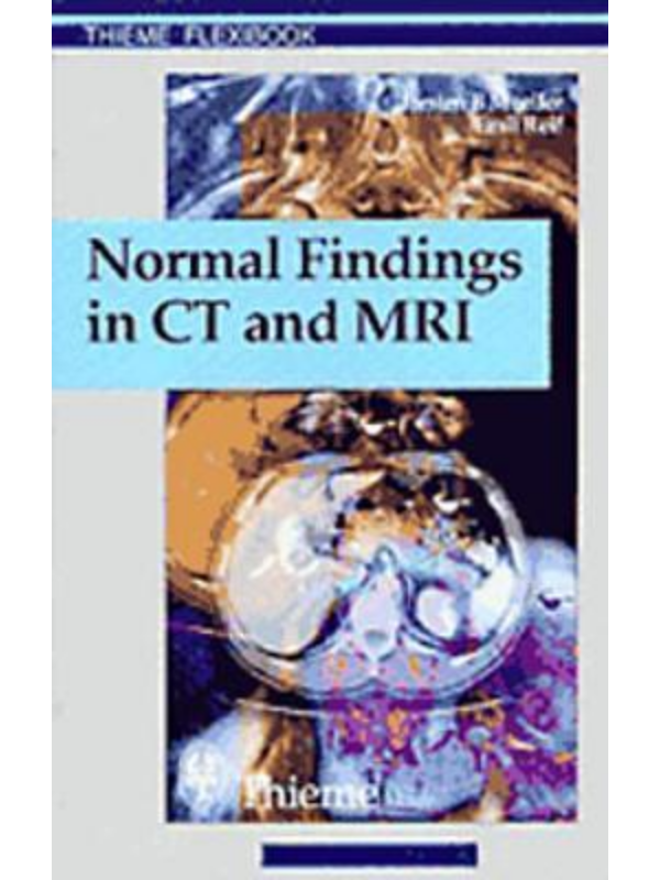 Normal Findings in CT and MRI