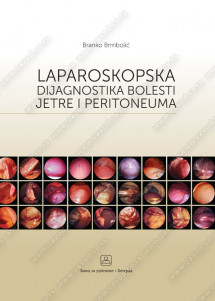 Laparoskopska dijagnostika bolesti jetre i peritoneuma