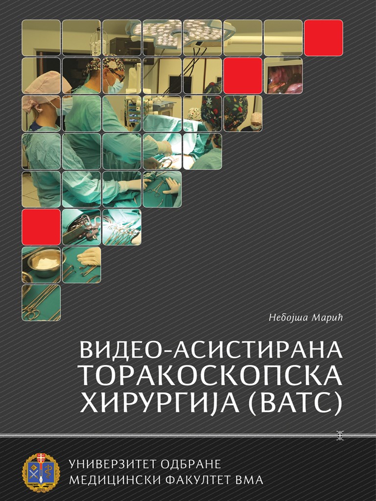 ВИДЕО-АСИСТИРАНА ТОРАКОСКОПСКА ХИРУРГИЈА
(ВАТС)