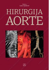 Hirurgija aorte