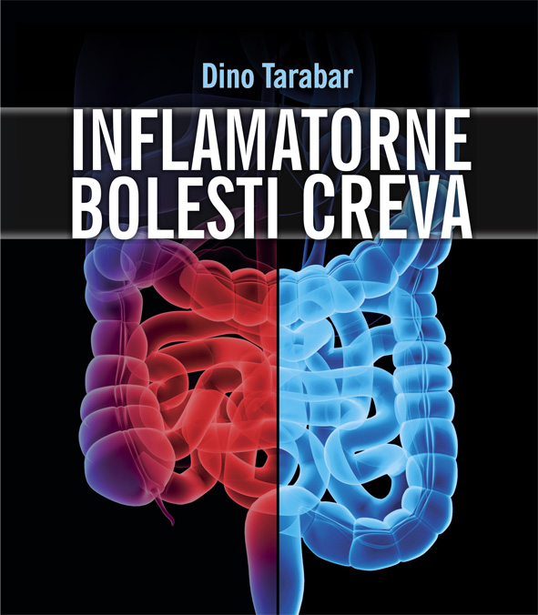 Inflamatorne bolesti creva