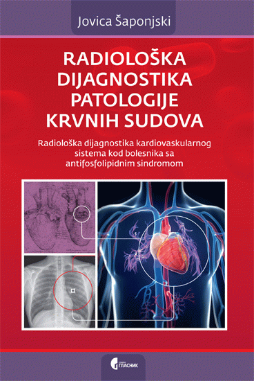 Radiološka dijagnostika kardiovaskularnog sistema kod bolesnika sa antifosfolipidnim sindromom
