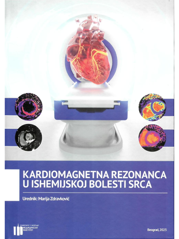 Kardiomagnetna rezonanca u ishemijskoj bolesti srca