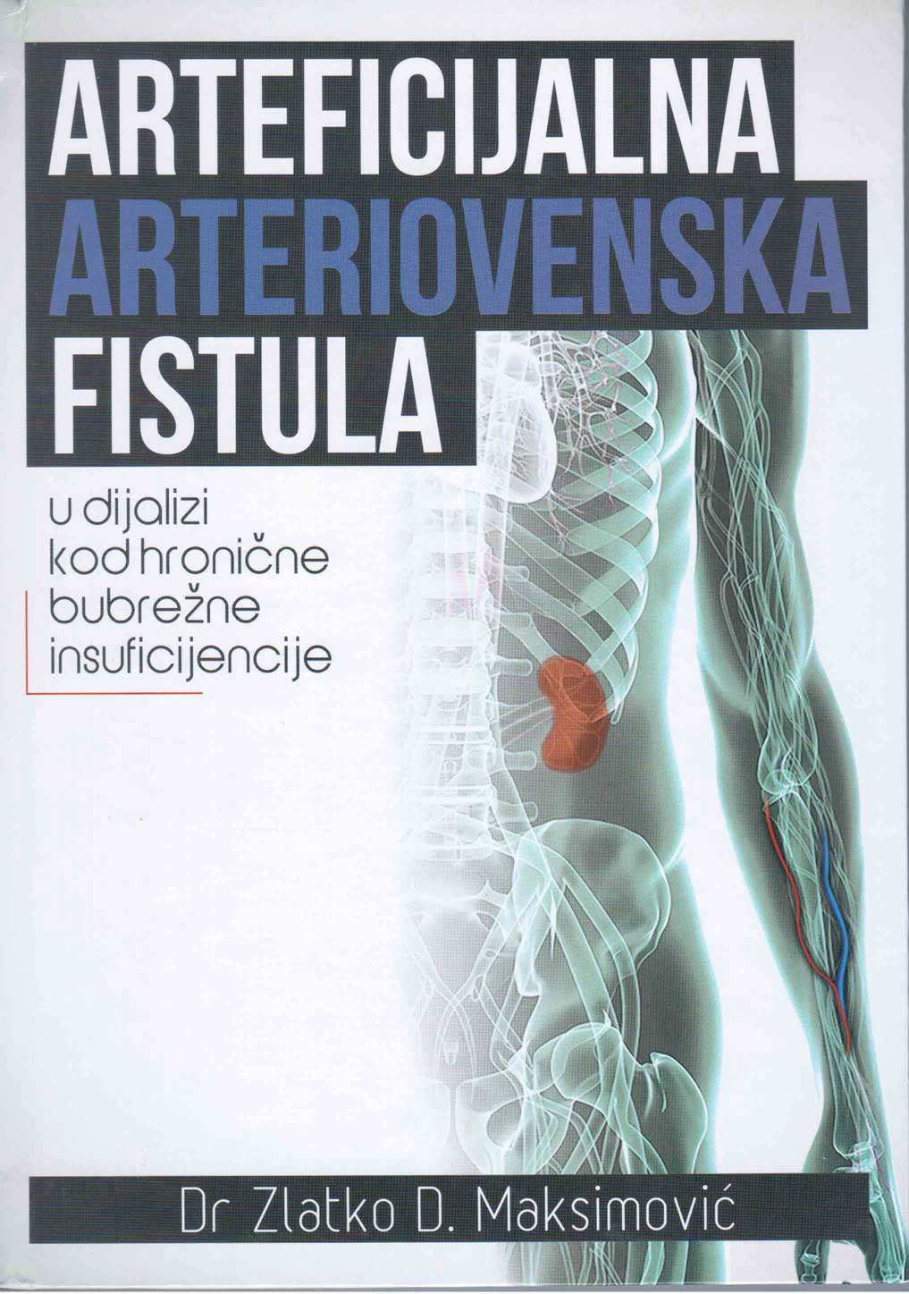 Arteficijalna arteriovenska fistula
