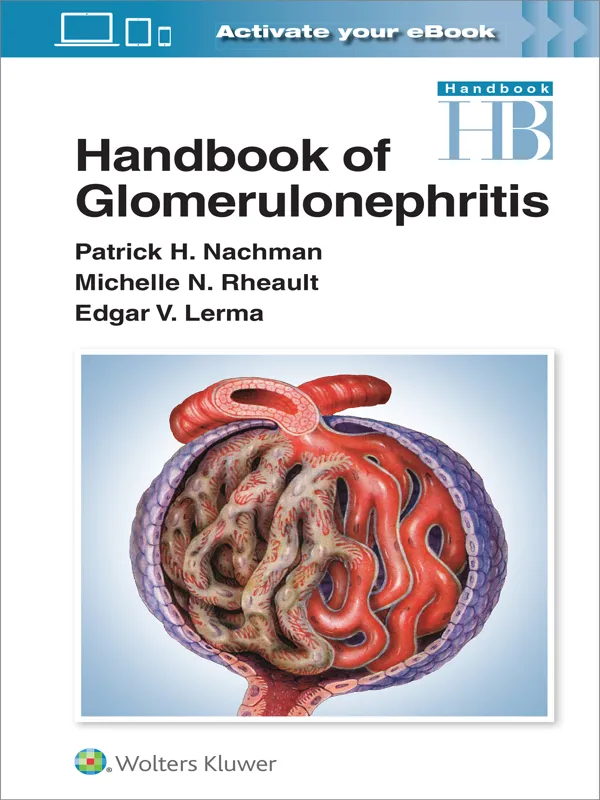 Handbook of Glomerulonephritis First Edition
