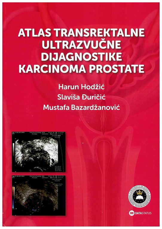 Atlas transrektalne ultrazvučne dijagnostike karcinoma prostate