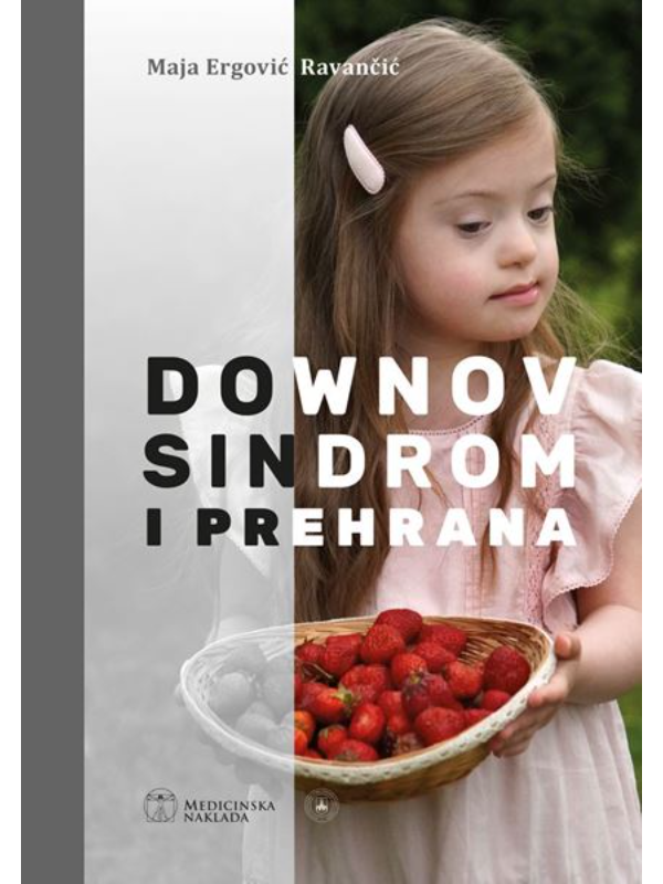 DOWNOV SINDROM I PREHRANA