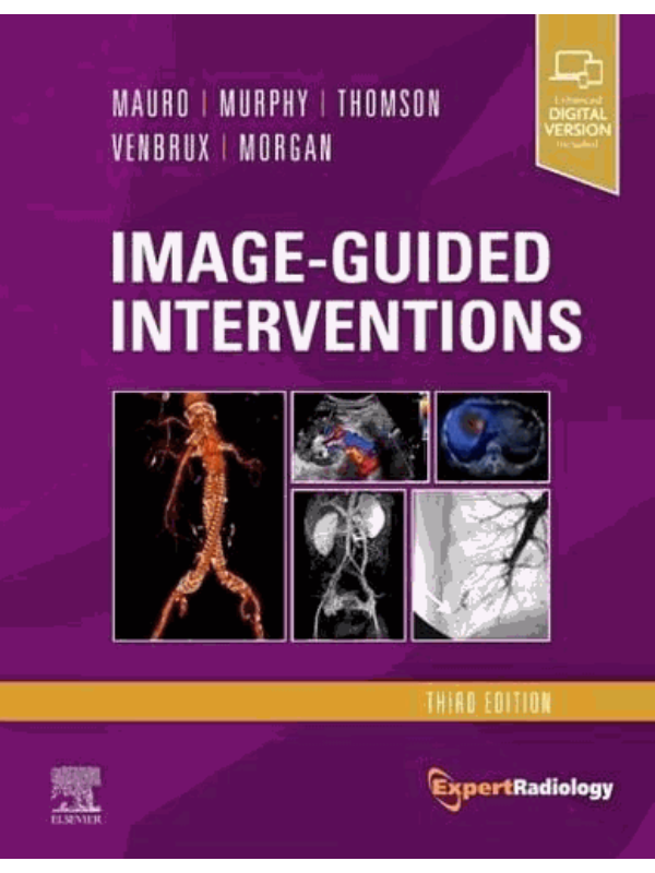 Image-Guided Interventions