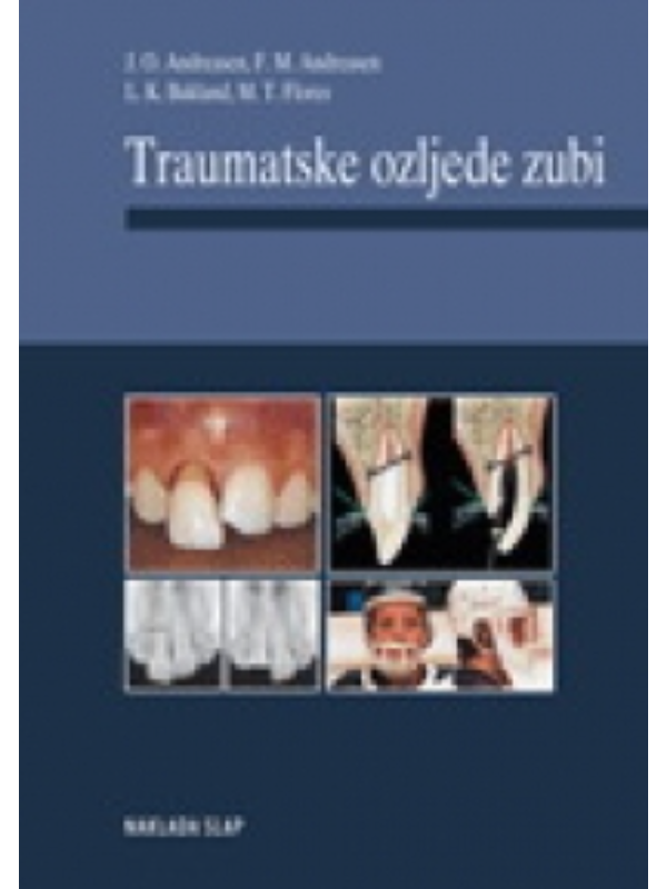 Traumatske ozljede zubi