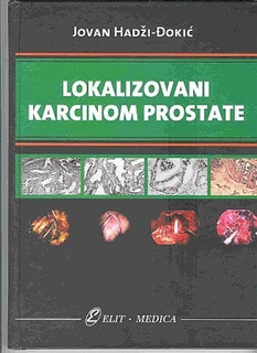 Lokalizovani karcinom prostate