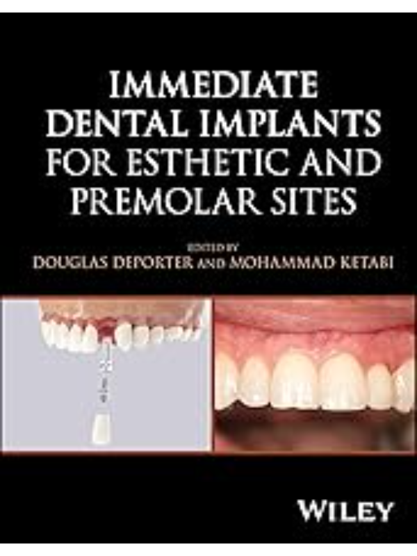 Immediate Dental Implants for Esthetic and Premolar Sites