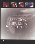 Resekciona hirurgija jetre + CD