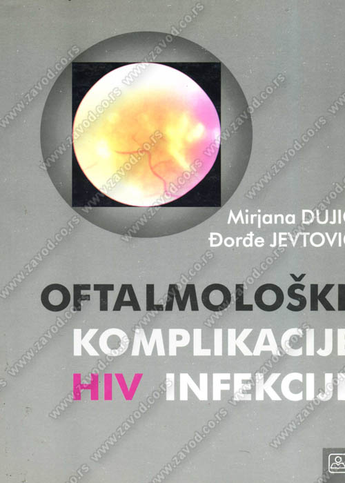 Oftalmološke komplikacije izazvane hiv infekcijom
