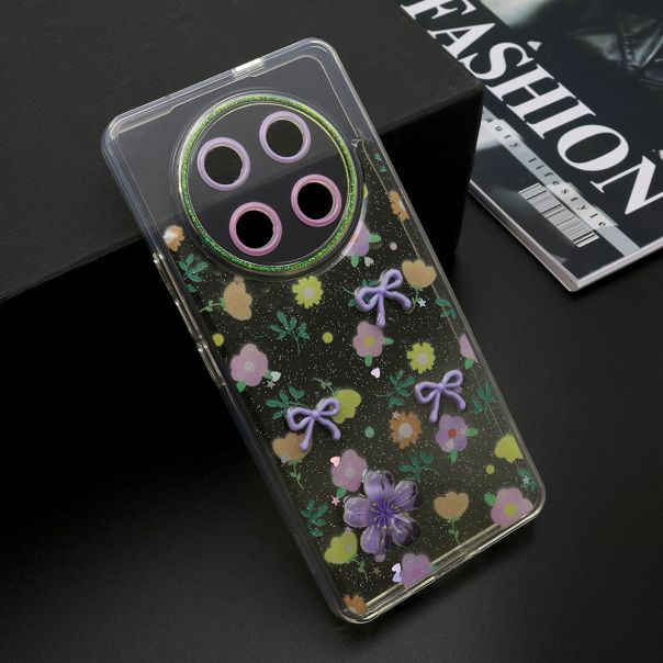 Maska Whisper za Honor X9C/Magic 7 lite, žuta