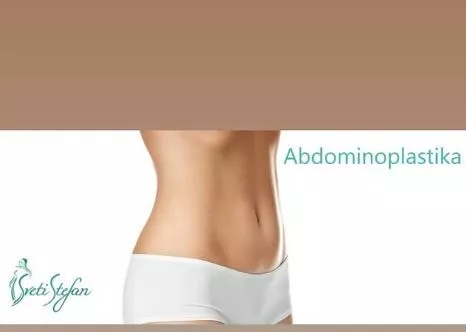 Abdominoplastika