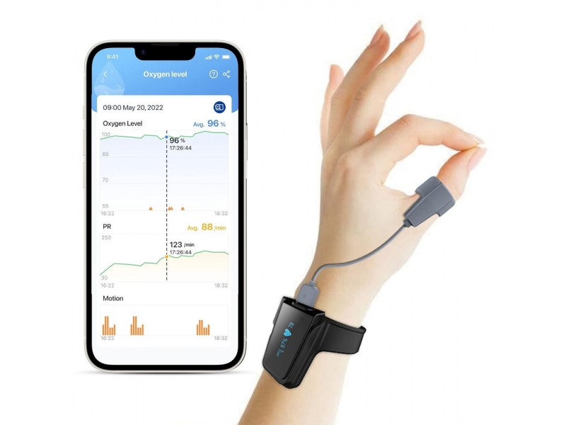 Pulsni oksimetar sa aplikacijom ViATOM Checkme O2