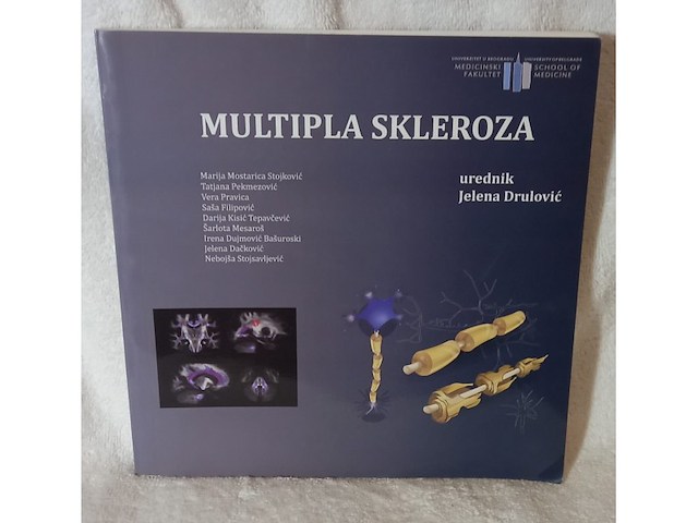 Multipla skleroza