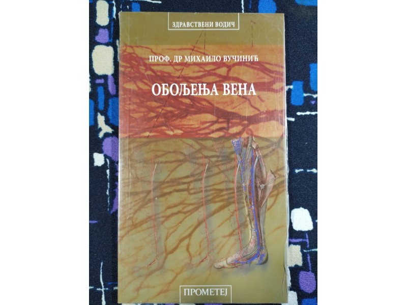 OBOLJENJA VENA - DR MIHAILO VUCINIC (Novo)