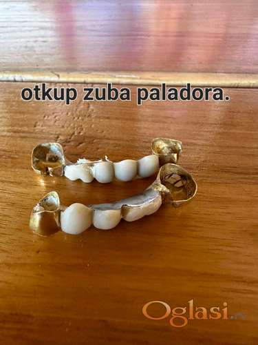 Zubi palador kupujem