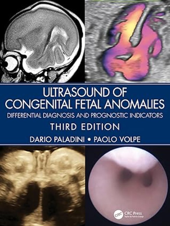 Ultrasound of Congenital Fetal Anomalies:3rd Edition Differential Diagnosis and Prognostic Indicators3rd edition