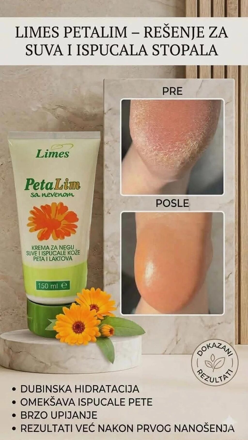 Limes PetaLim krema sa nevenom – intenzivna nega za suvu i ispucalu