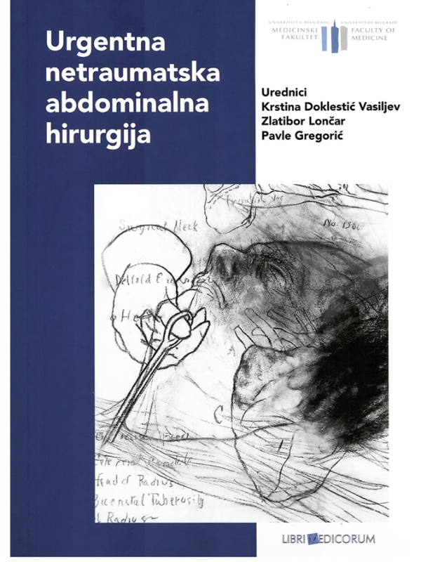 Urgentna netraumatska abdominalna hirurgija