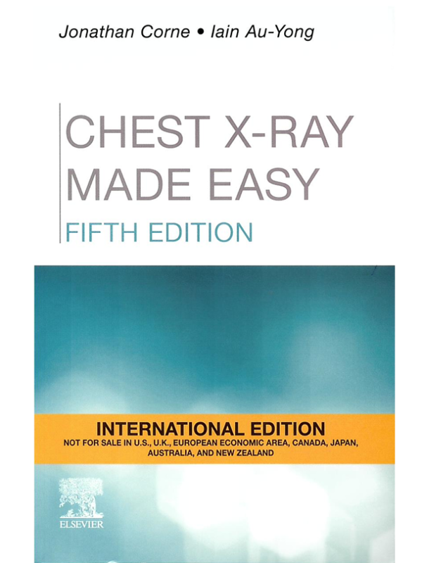 Chest X-Ray Made Easy, 5th Edition, International Edition