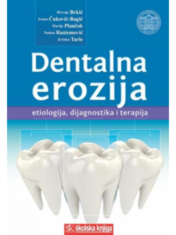 Dentalna erozija: etiologija, dijagnostika i terapija