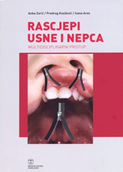 Rascjepi usne i nepca